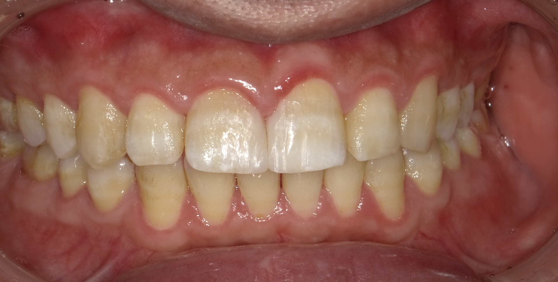 SHOFU DENTAL DIGITAL CAMERA | 桜山あしかり歯科｜名古屋市瑞穂区の歯医者