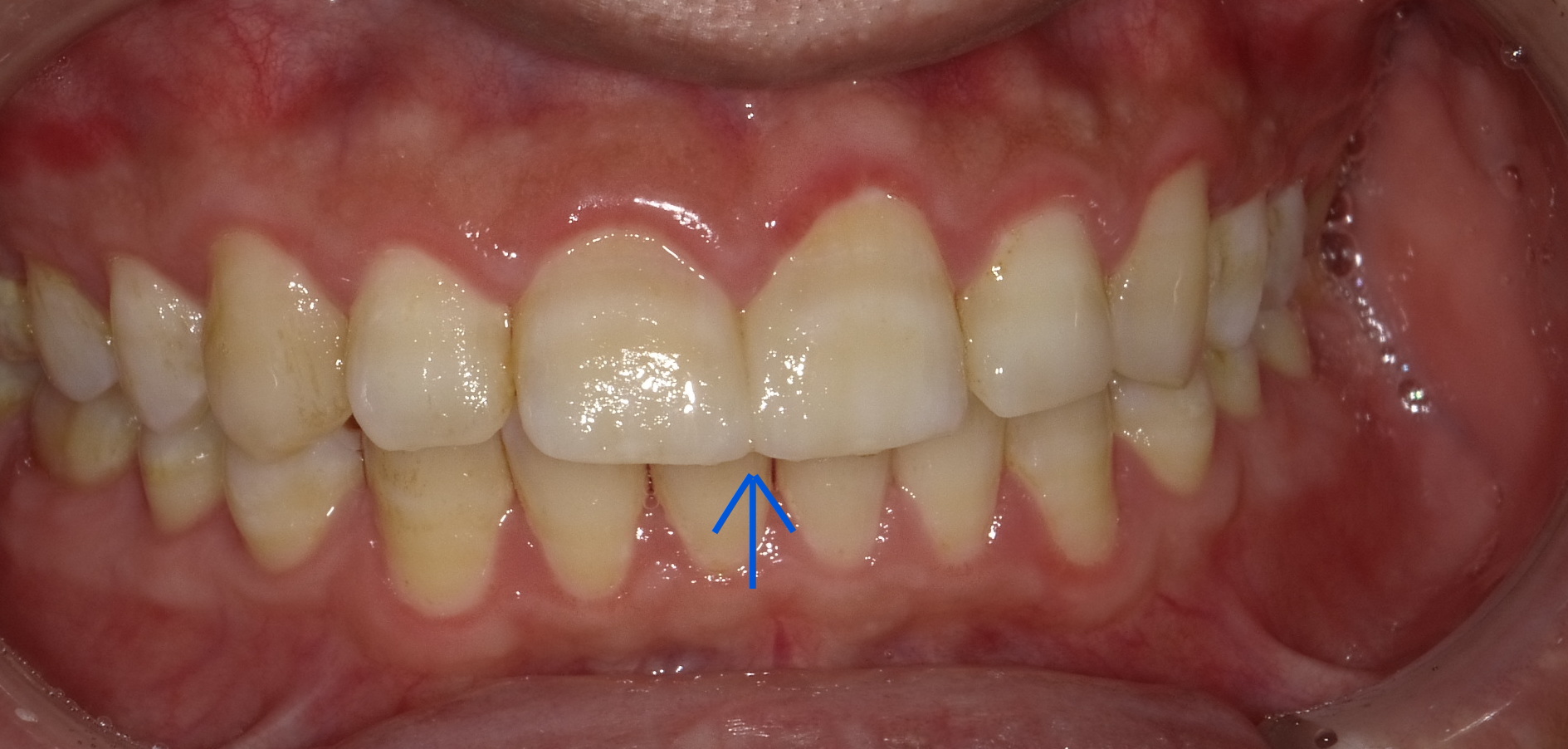 SHOFU DENTAL DIGITAL CAMERA | 桜山あしかり歯科｜名古屋市瑞穂区の歯医者